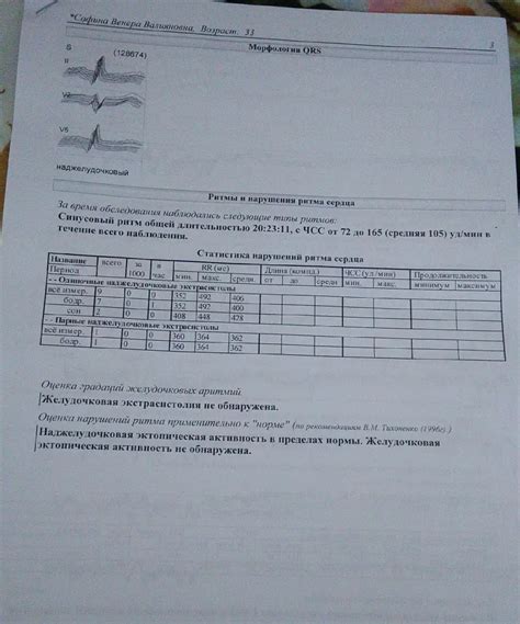 Расшифруйте холтеровское исследование Холтеровское мониторинг нормально ...