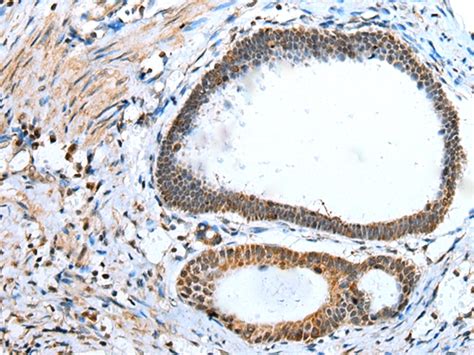 Dcxr Antibody Sab Signalway Antibody