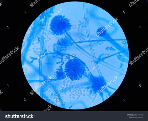 Aspergillus Microscope
