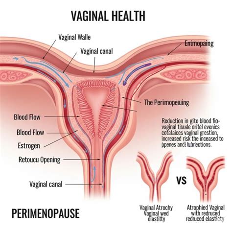 Medical Understanding Vaginal Health During Perimenopause A Crucial
