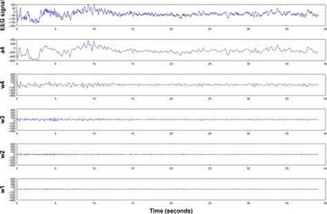 full article automatic epilepsy detection using fractal dimensions segmentation and gp svm