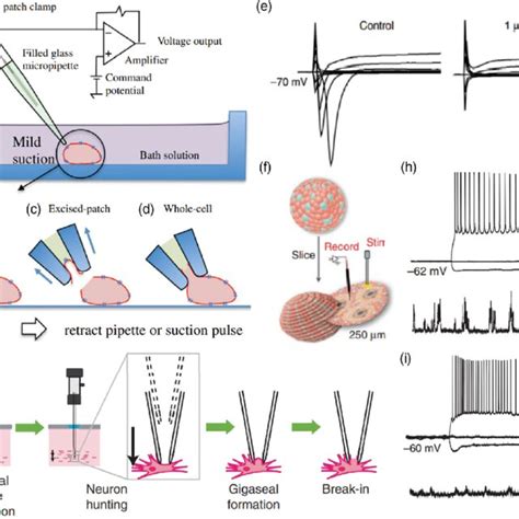 Patch Clamp A Schematic Illustration Of The Methods For Patch Clamp Download Scientific