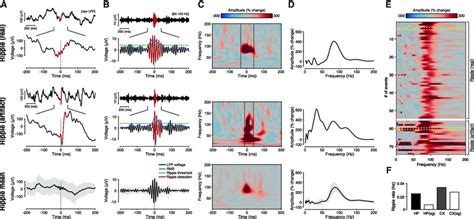 ripple detection and artifact rejection a example raw voltage traces