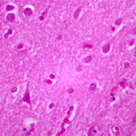 Cerebrum Microscope Slide Labeled At Cristal Justice Blog