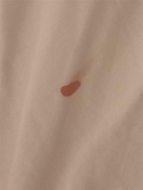 Does This Look Like Bed Bug Blood Marks Rbedbugs