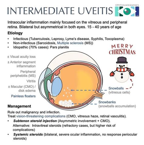 Intermediate Uveitis Credit On Photo Zahra Medicare