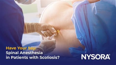 Spinal Anesthesia In Patients With Scoliosis