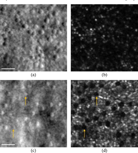 Figure 1 From Deep Learning Based Detection Of Cone Photoreceptors With Multimodal Adaptive
