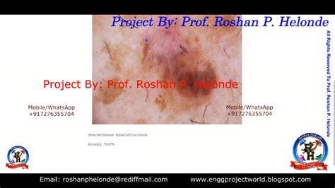 Skin Disease Detection Using Deep Learning Cnn Skin Disease Classification Using Python