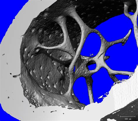 骨小梁 组织工程 杭州越波生物科技有限公司