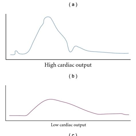 Thermodilution Cardiac Output Curves Used With Permission From 8 Download Scientific Diagram