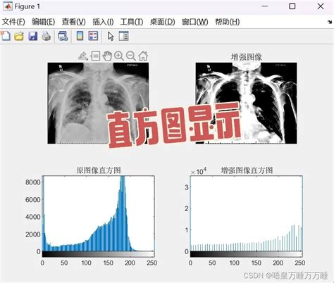 Matlab胸片分割系统 Csdn博客