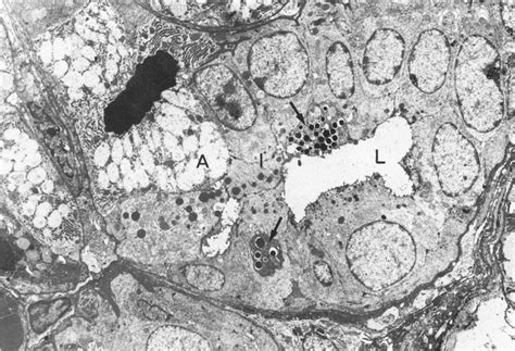 Ultrastructural Features Of Normal Rat Submandibular Gland At The Download Scientific Diagram