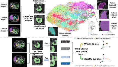 Semantic Aware Contrastive Learning For Multi Object Medical Image Segmentation Pmc