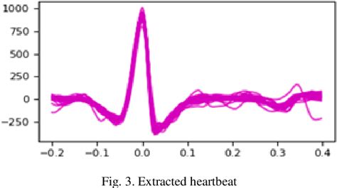 Figure 1 From Machine Learning Methods In Ecg Classification Semantic Scholar