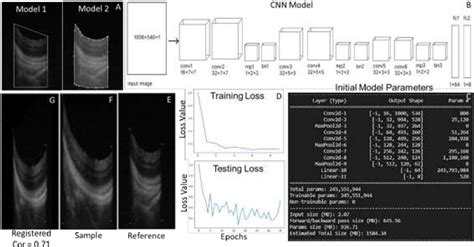 figure 4 from ai pipeline for accurate retinal layer segmentation using