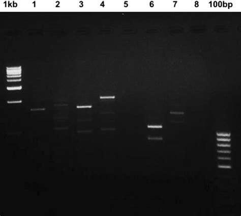 Rapd Analysis Of Active Erinlg 201 Isolate Using Primers 1 Opa 9 Download Scientific Diagram