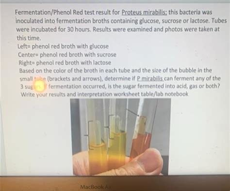 Mrvp And Citrate Labs Worksheet Mrvp Data Name Of