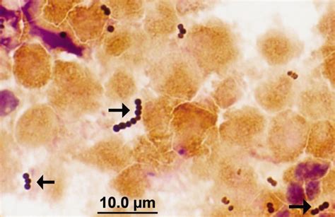 Streptococcus Phocae Isolated From A Spotted Seal Phoca Largha With Pyometra In Alaska