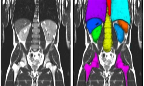Pattern Recognition Machines Are Learning Fast • Healthcare In