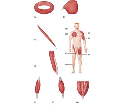 Patterns Of Fascicle Arrangement Quiz