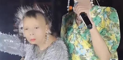 Xiao Xiao Disability Illness Avm And Medical Condition