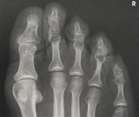 Projections Flashcards Quizlet