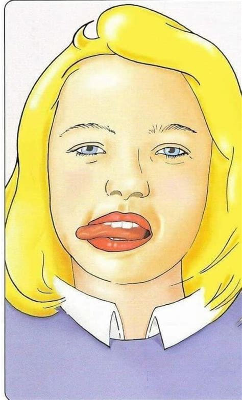 Өгүүлэх эрхтний дасгалууд тавьж Хэл заслын цэцэрлэг