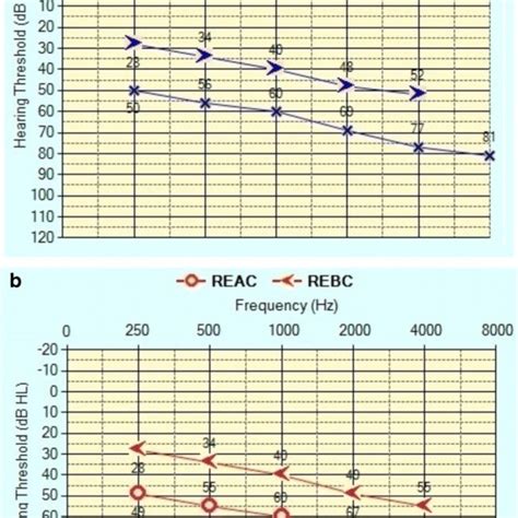 A B Average Of The Measured Minimum Threshold Of Hearing At The Test