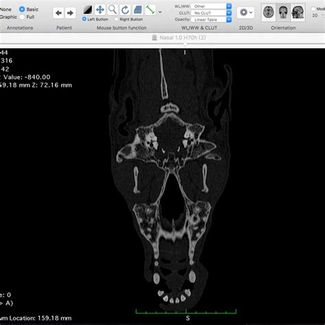 2 Slice Function In Dicom Viewer Left And In Unity Right