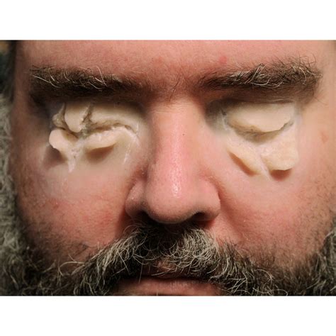 Gouged Out Eyes Prosthetics Encapsulated Silicone Ripped Out Eyes