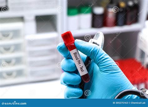 Blood Ph Test To Look For Abnormalities From Blood Stock Image Image