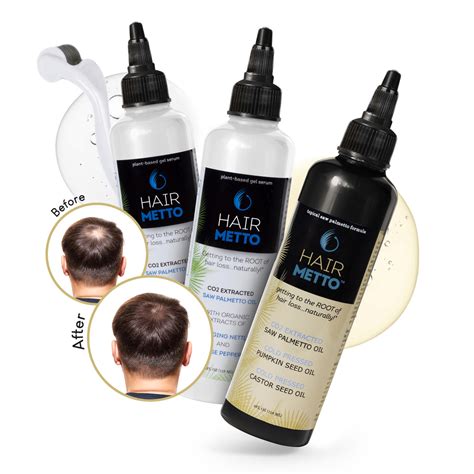 Topical Dht Blockers To Combat Hair Loss Hairmetto