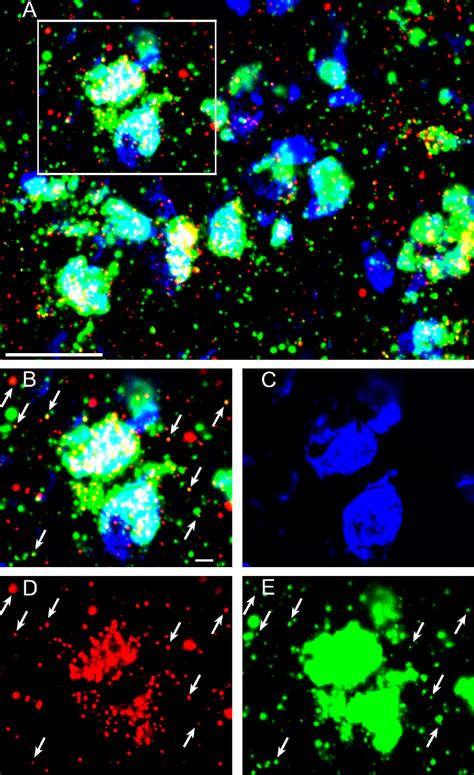 Figure 4 From Expression Of The Core Exon Junction Complex Factor Eif4a3 Is Increased During