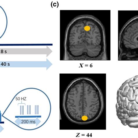 Transcranial Magnetic Stimulation Protocol And Target A Itbs Download Scientific Diagram