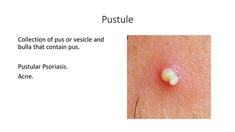 Ppt Language Of Dermatology Powerpoint Presentation Free Download