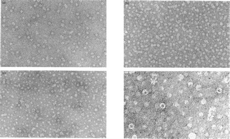 Electron Microscopy Of Mcp Particles Negatively Stained In Uranyl Download Scientific Diagram