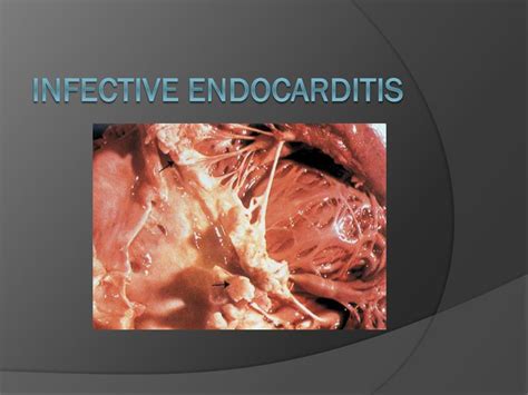 Ppt Fingernails Powerpoint Presentation Free Download Id5330213