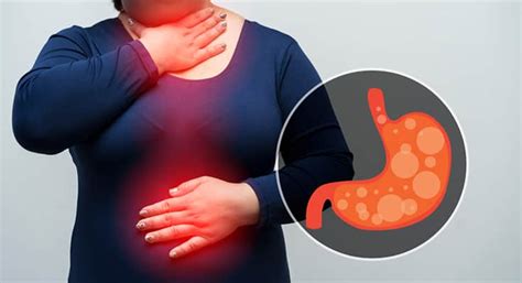Acid Reflux 12 Easy Home Remedies To Treat Gas And Acidity