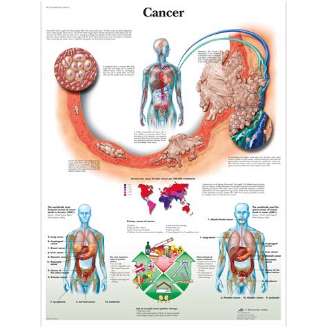 Cancer Chart Sem Trainers