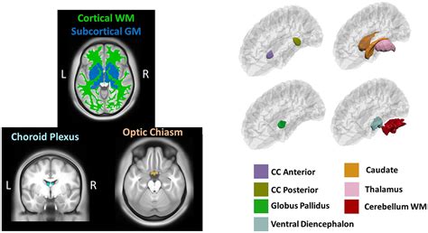 Frontiers Brain Morphological Variability Between Whites And African