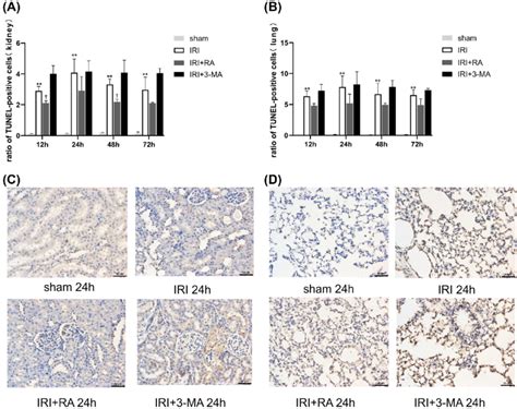 The Ratio Of Tunel Positive Cells Number Of Apoptotic Cells Number Download Scientific
