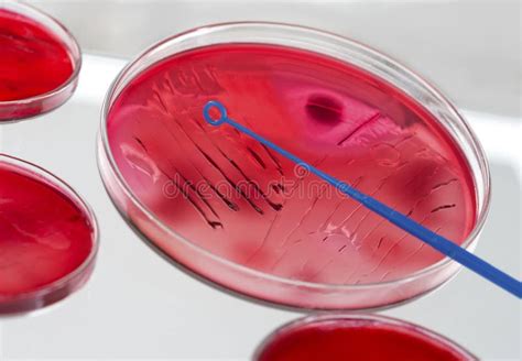INOCULATION MICROBIOLOGY Stock Photo Image Of Specimen 46654326
