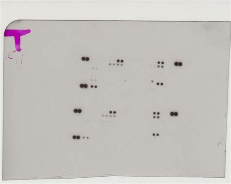 Proteome Profiler Human Phospho Kinase Array Kit Ary003b Randd Systems