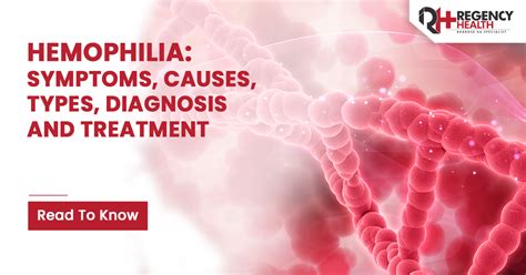 Hemophiliac Patient With Aids Treatment