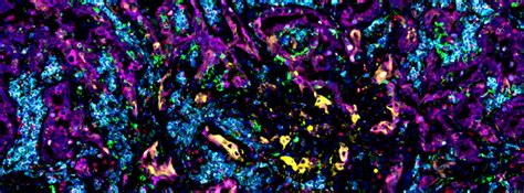 Multiplex Solutions For Spatial Biology Cell Signaling Technology