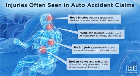 North Carolina Car Accident Lawyers James Scott Farrin