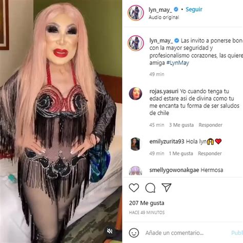 Lyn May Impact En Redes Con Invitaci N Para Tratamiento De Botox Las Invito A Ponerse Bonitas