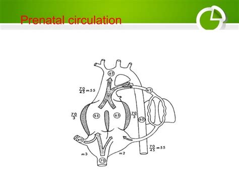 Truncus Final Truncus Final Ppt