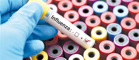 Удължават грипната епидемия в Плевен